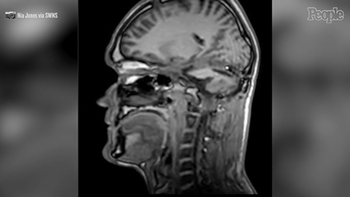 27-year-old demands MRI, told he has ‘days to live’ after doctors ...