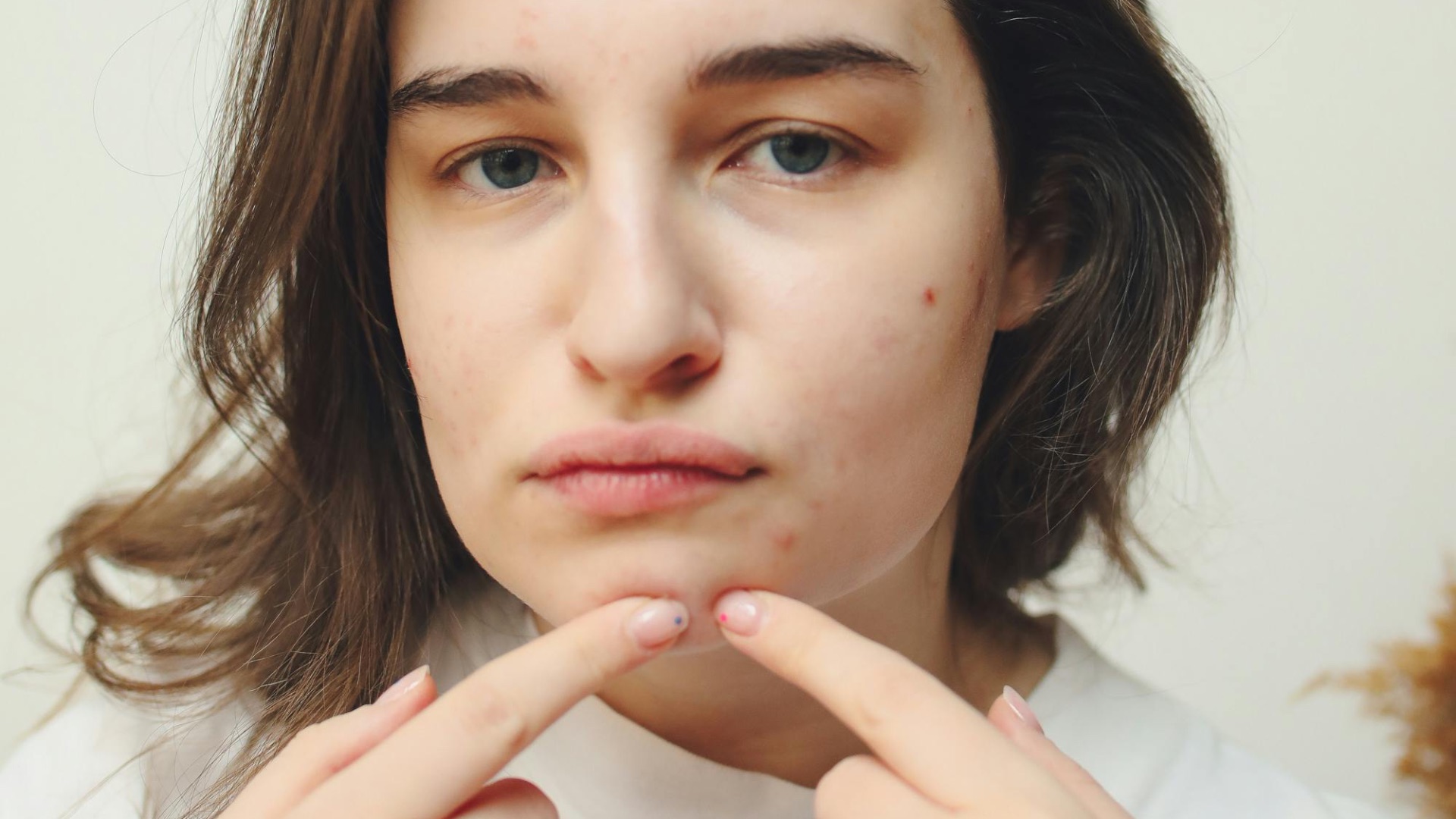 10 raisons pour lesquelles les patchs anti-boutons sont vraiment ...