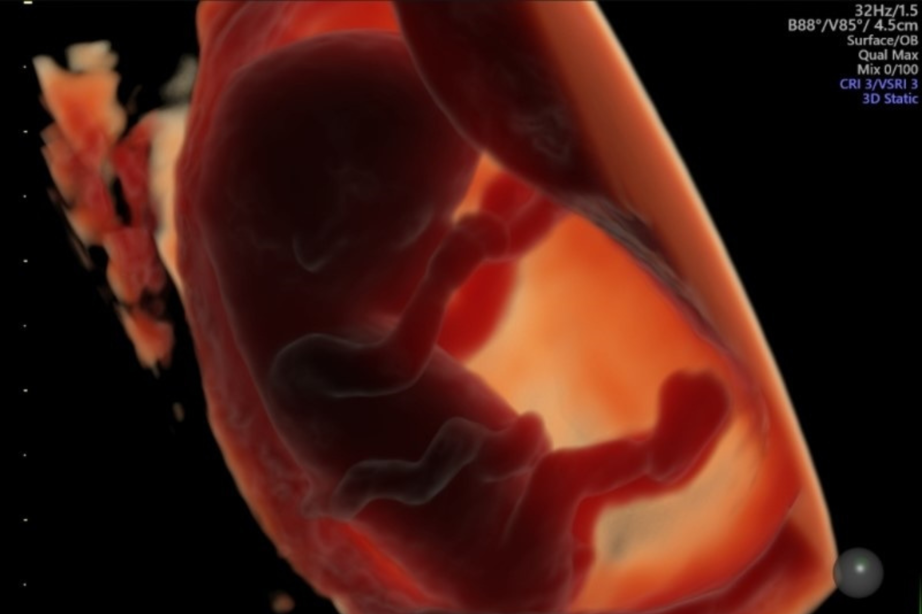 Common foods linked to reduced male fertility and slower embryo growth