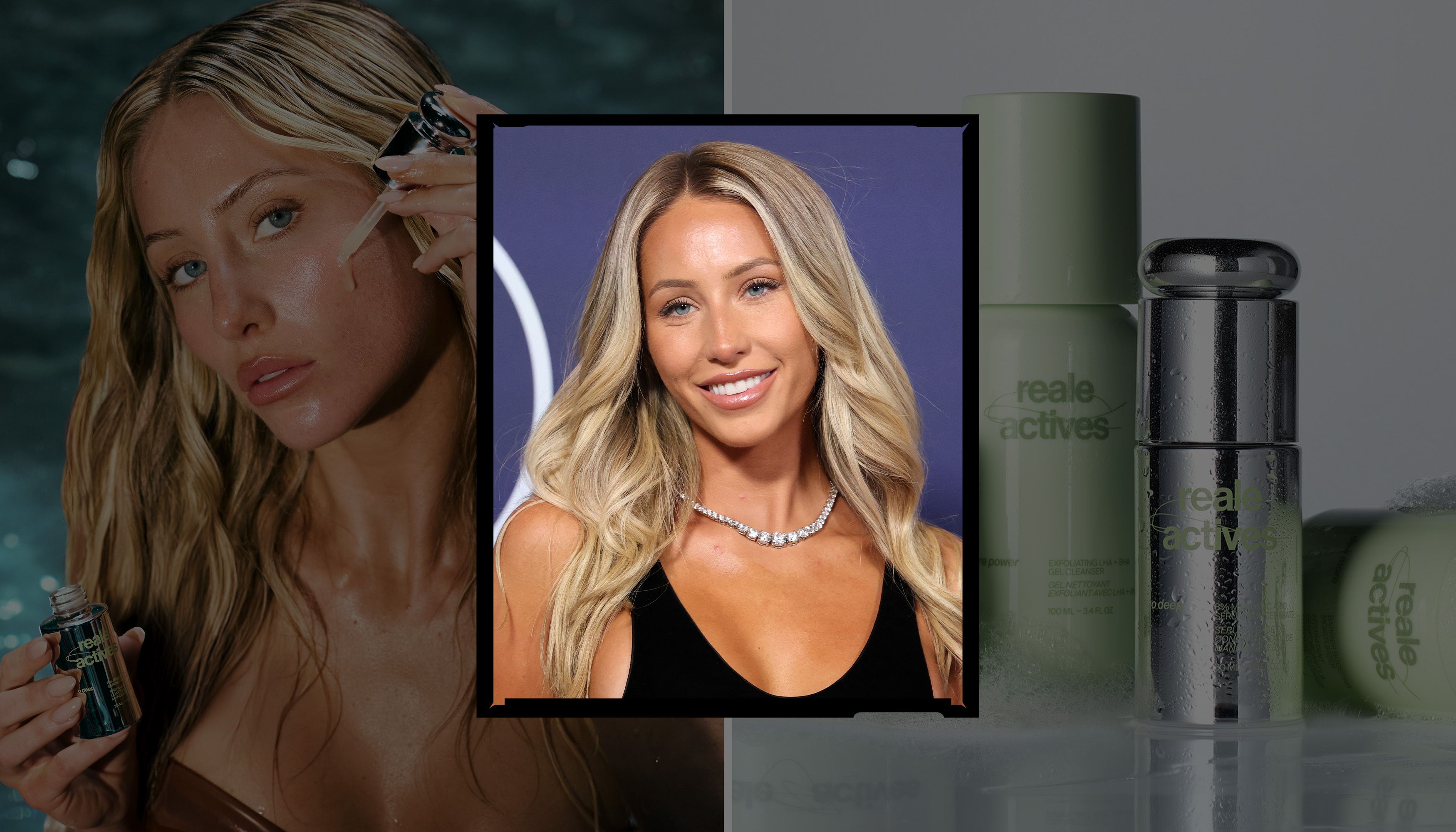 Alix Earle wants to make acne sexy and hot