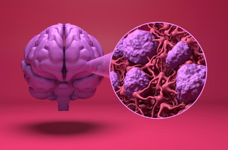A weekly home-cooked meal can slash older people’s risk of dementia
