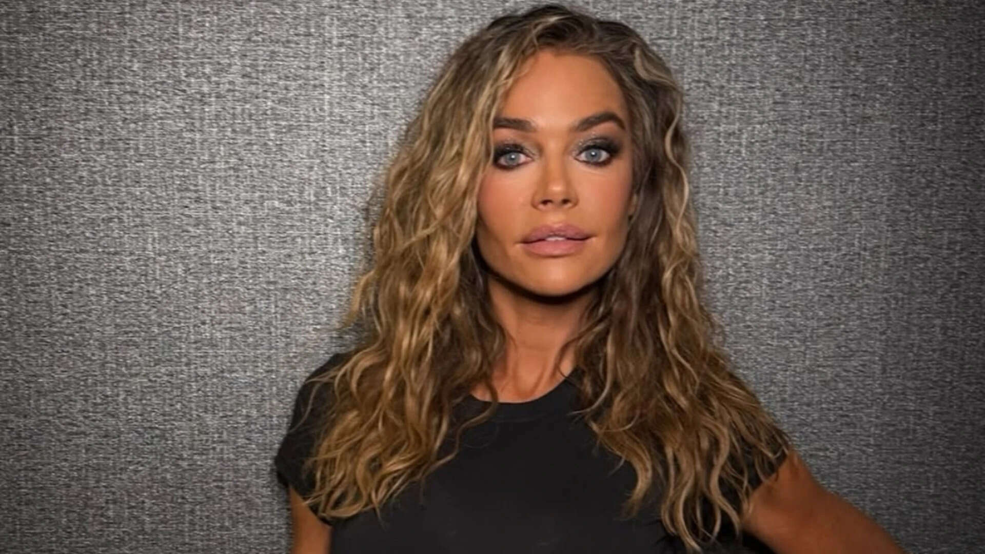 Denise Richards goes candid about her facelift surgery: 'It changed the ...