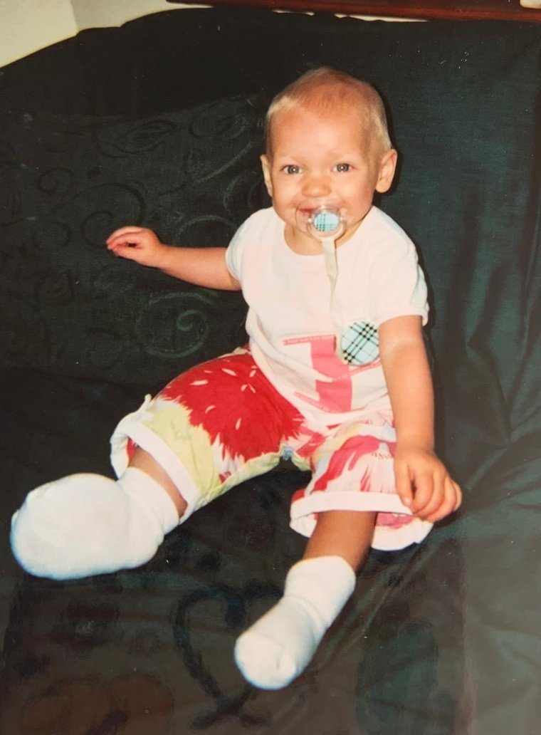 I have one foot – I’m searching for fellow amputee to share shoes with