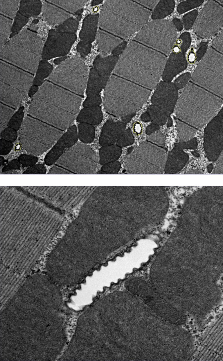 Massive insect body size 300 million years ago may not have been due to ...