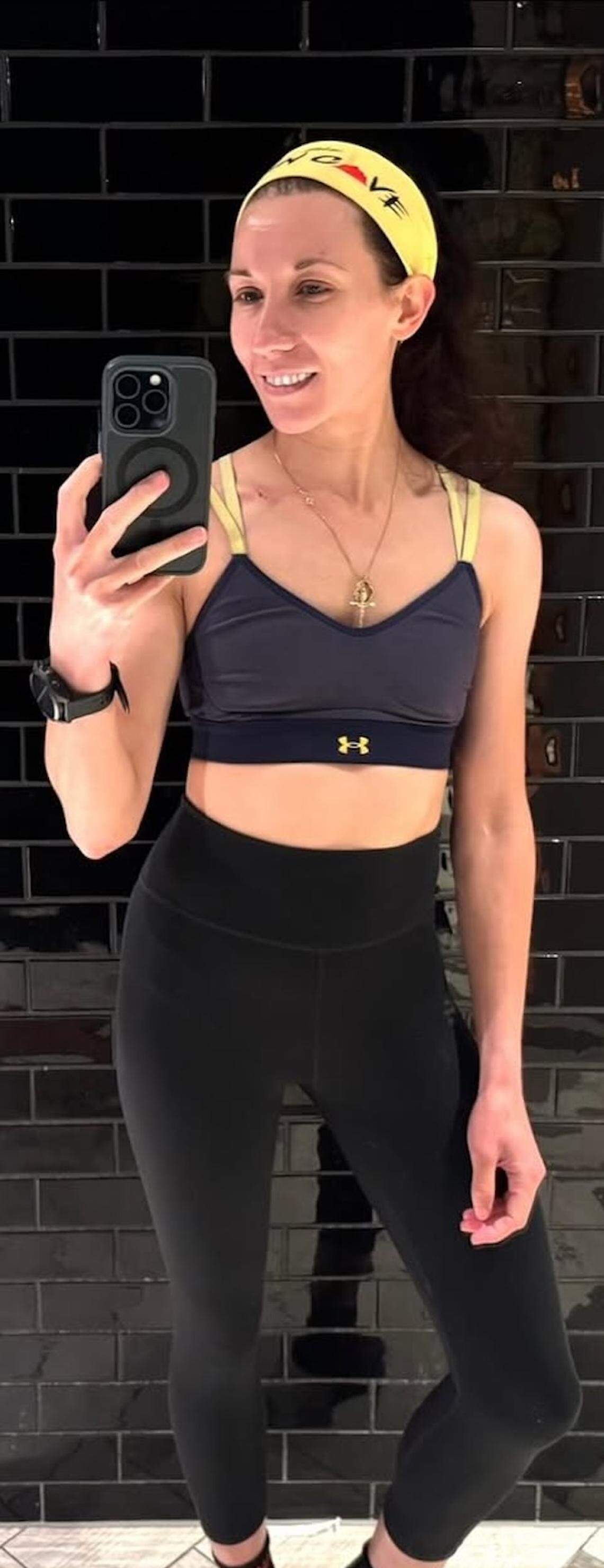 Runner bitten by wild dog mid-race in Kyrgyzstan kept going to the ...