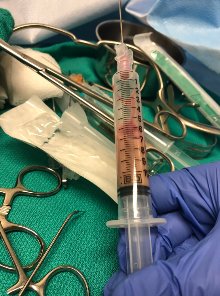 24 disturbing medical facts that I probably didn't need to know, but am ...