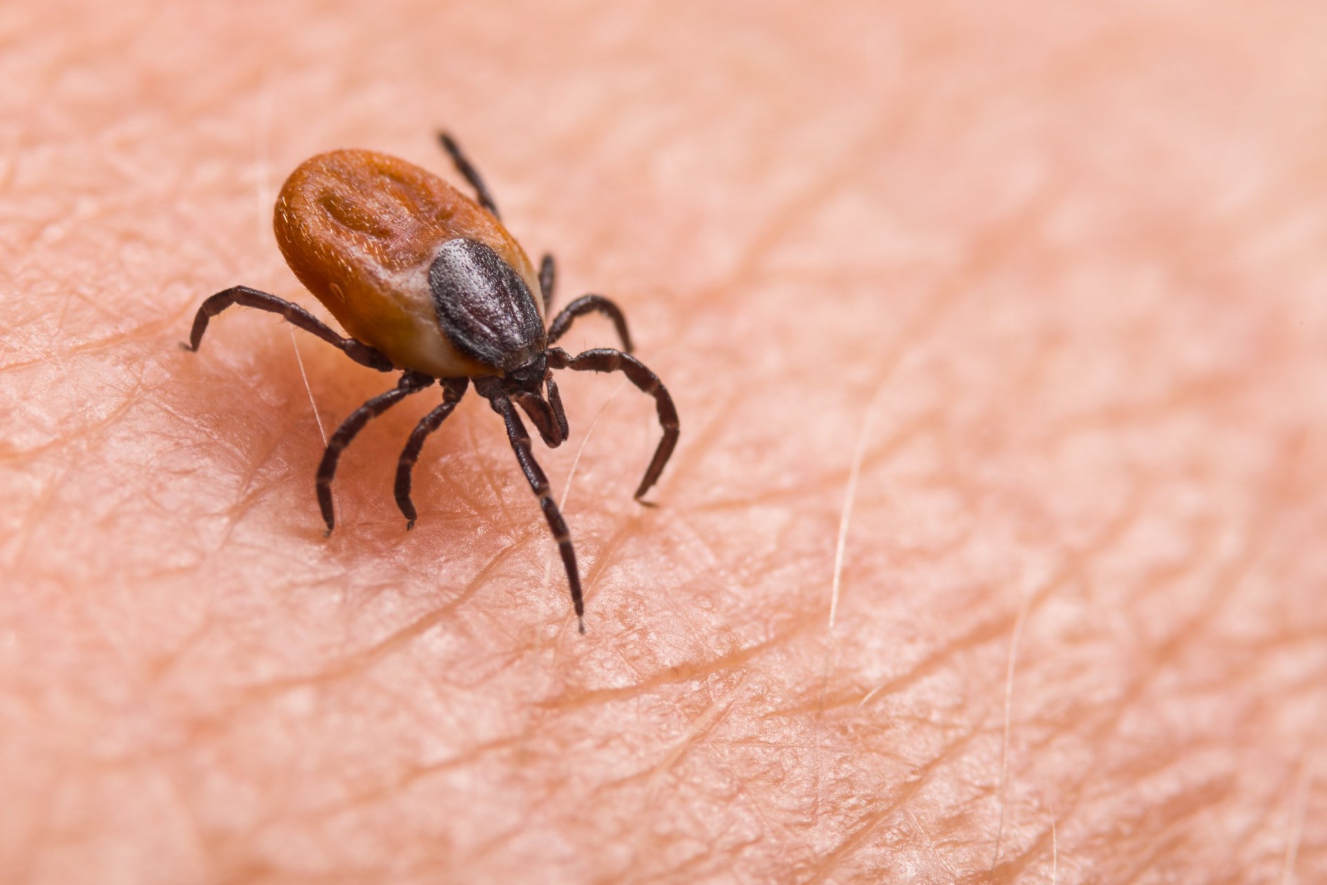 What is alpha-gal syndrome? The disease which makes people allergic to ...