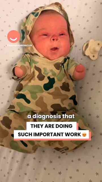 Watch Why This Cute Baby Was Born With Half of His Arms and Legs