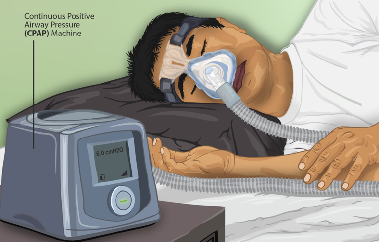 New innovations for sleep apnea sufferers offer relief