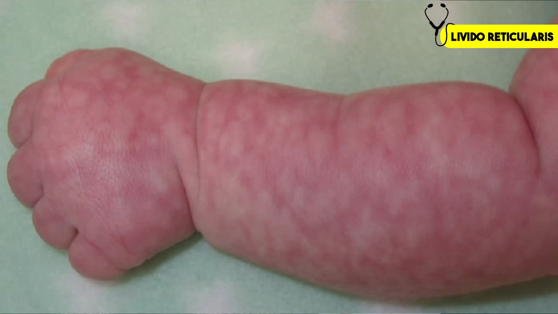 These small skin changes could signal big heart problems
