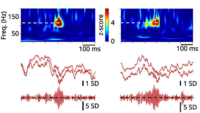 A single workout can rewire your brain’s memory circuits