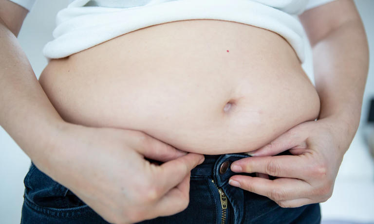 BMI system often misclassifies people as overweight or obese, research ...