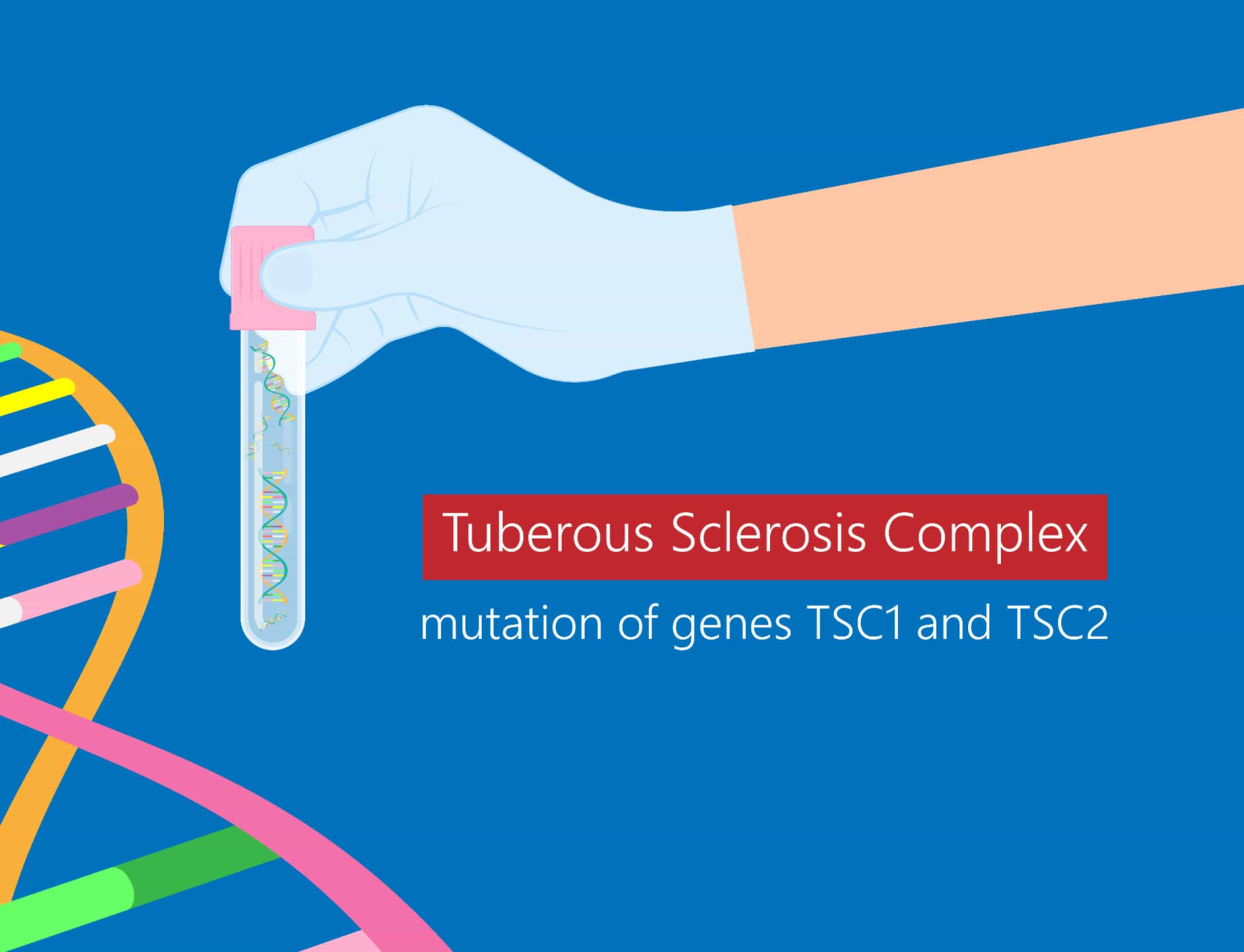 What do we know about tuberous sclerosis?