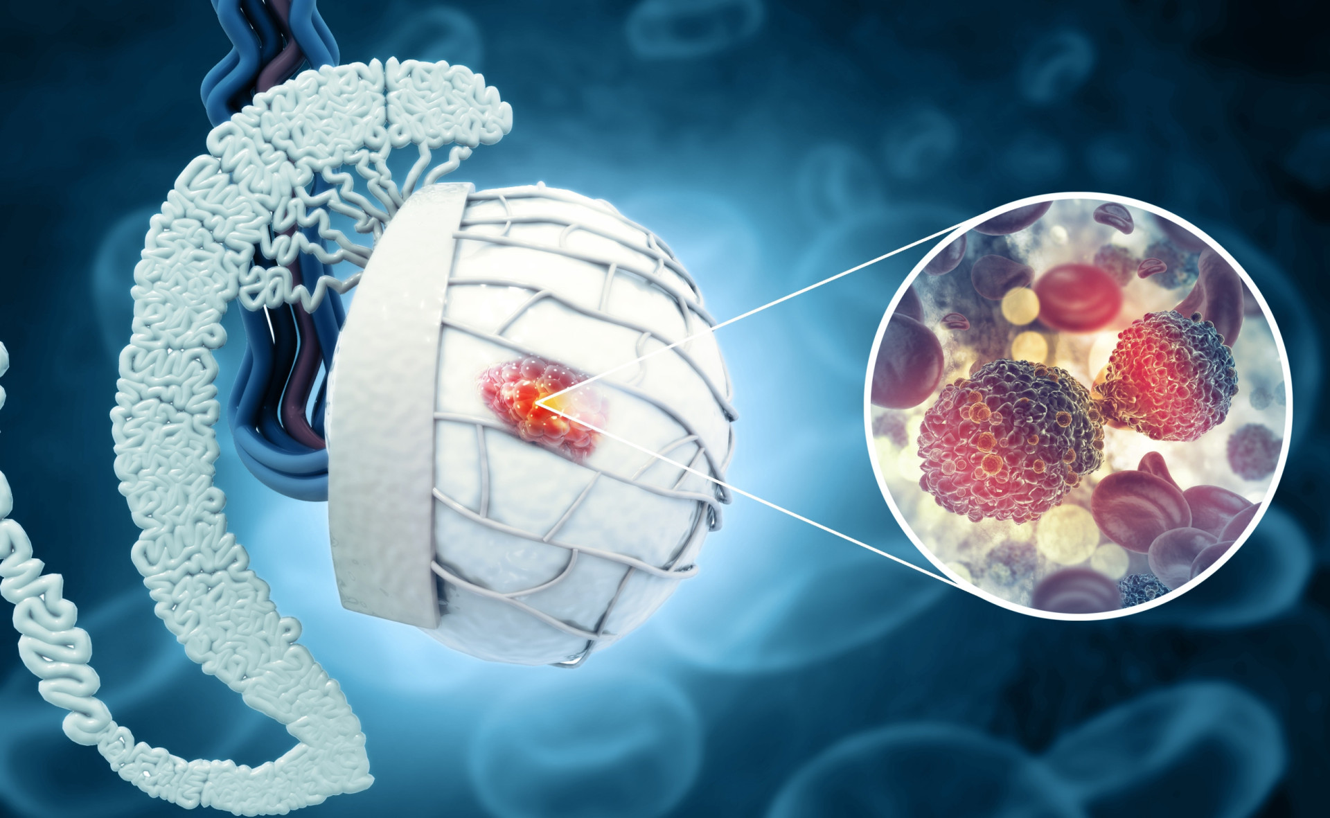 Hodenkrebs: Kennen Sie die Warnzeichen?