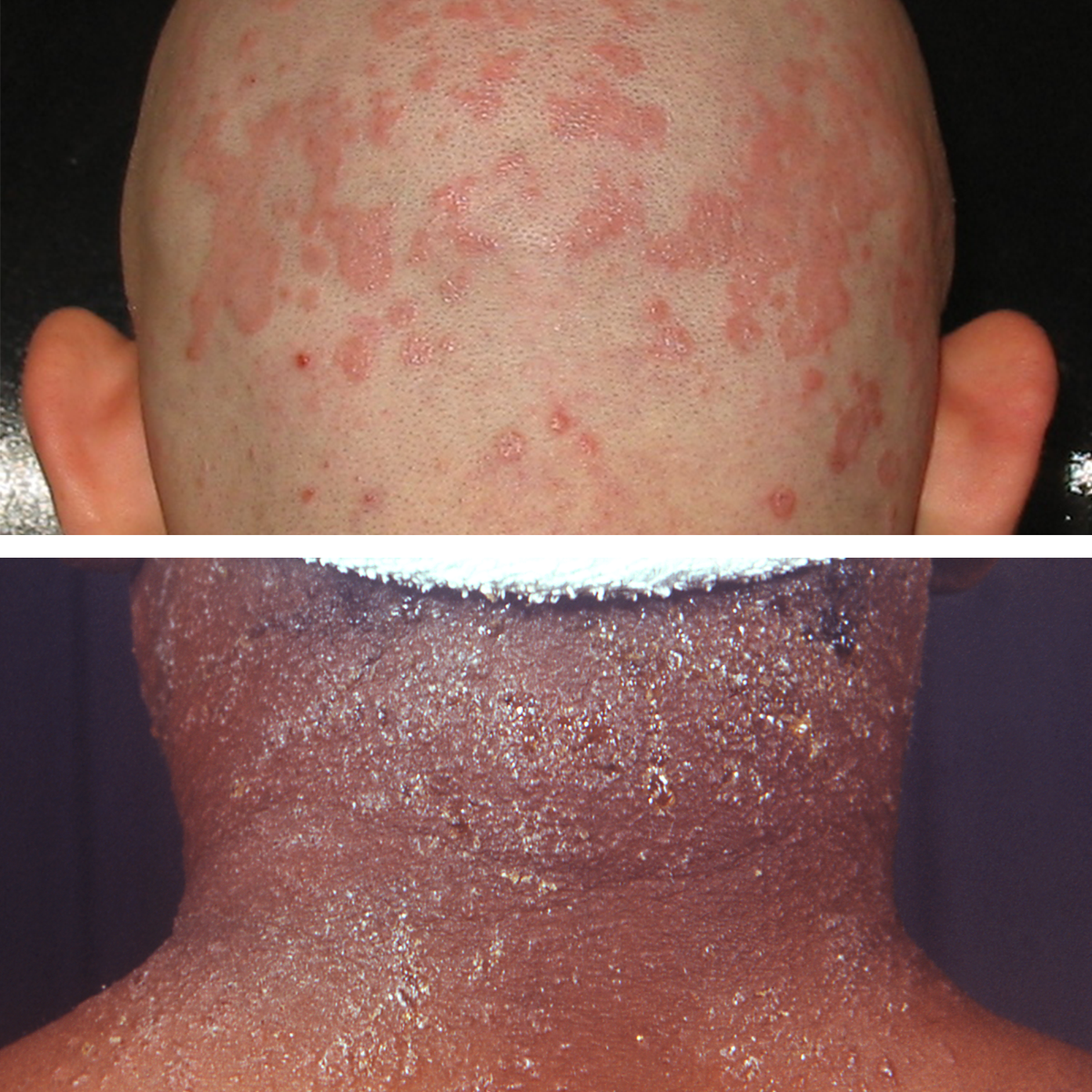 These Pictures Will Help You Identify the Most Common Skin Rashes