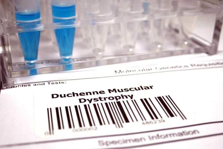 Solid Bio surges after trial data for lead asset in Duchenne