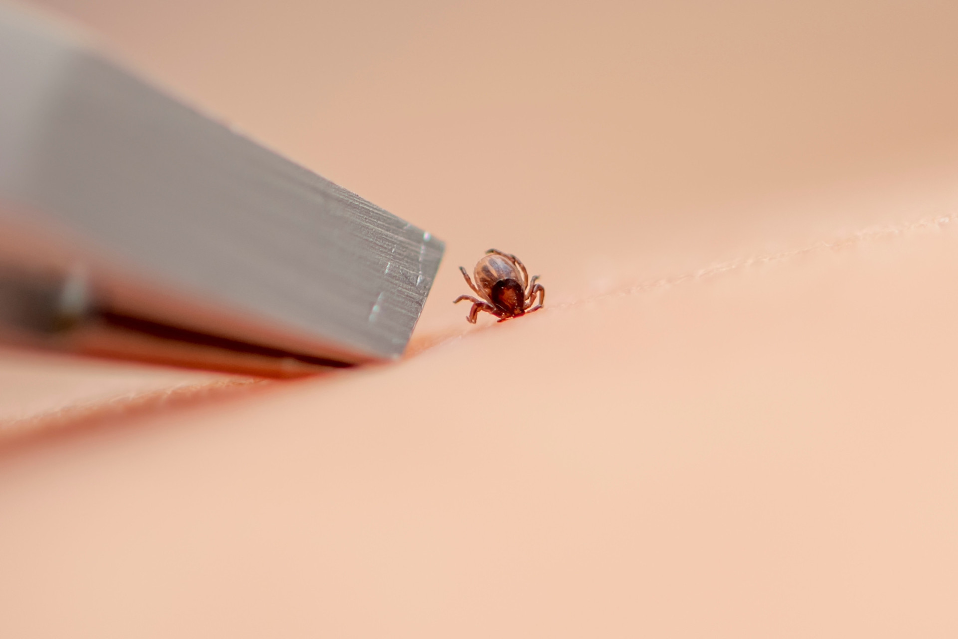 Understanding tick-related illnesses: Essential information and ...