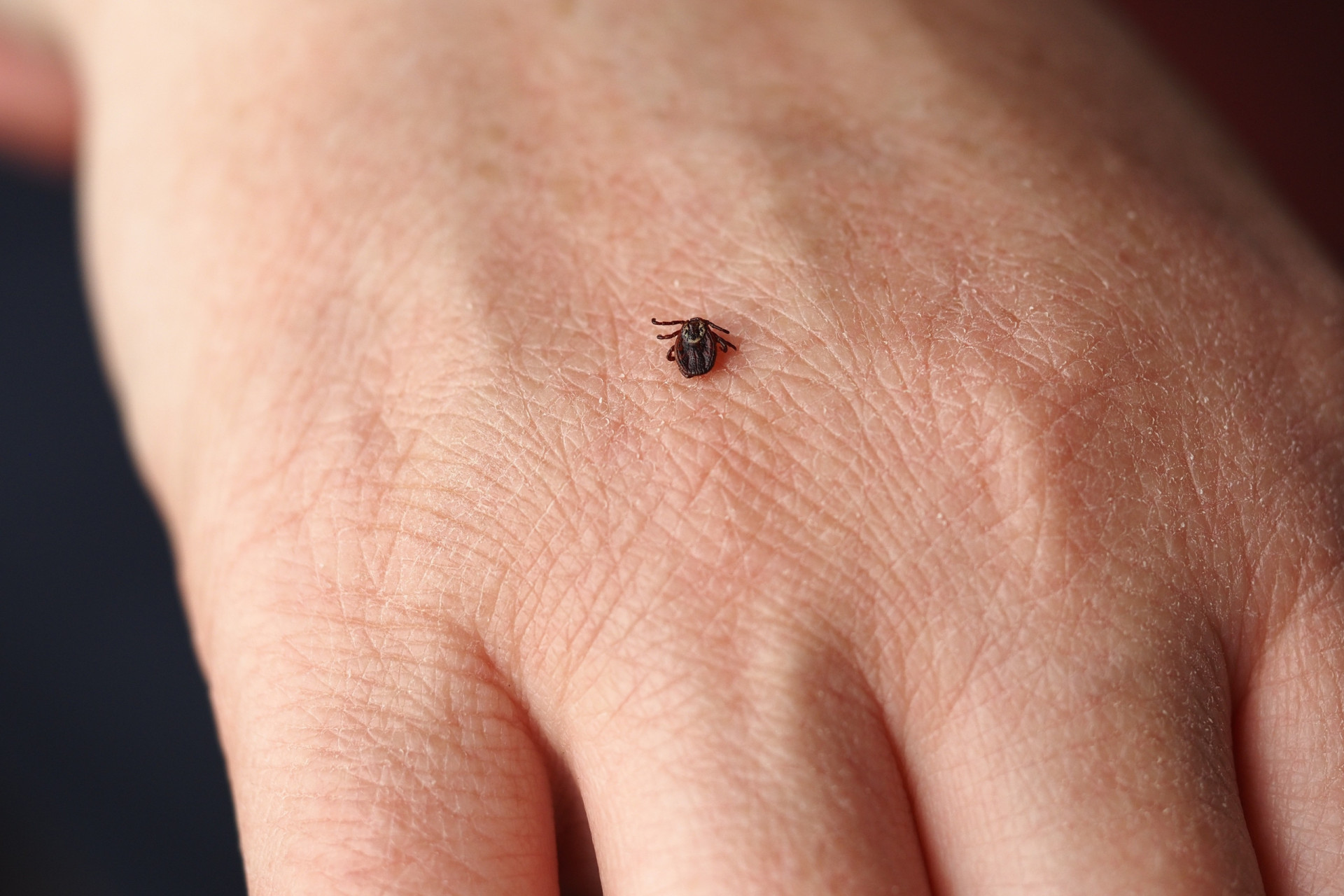 Understanding tick-related illnesses: Essential information and ...