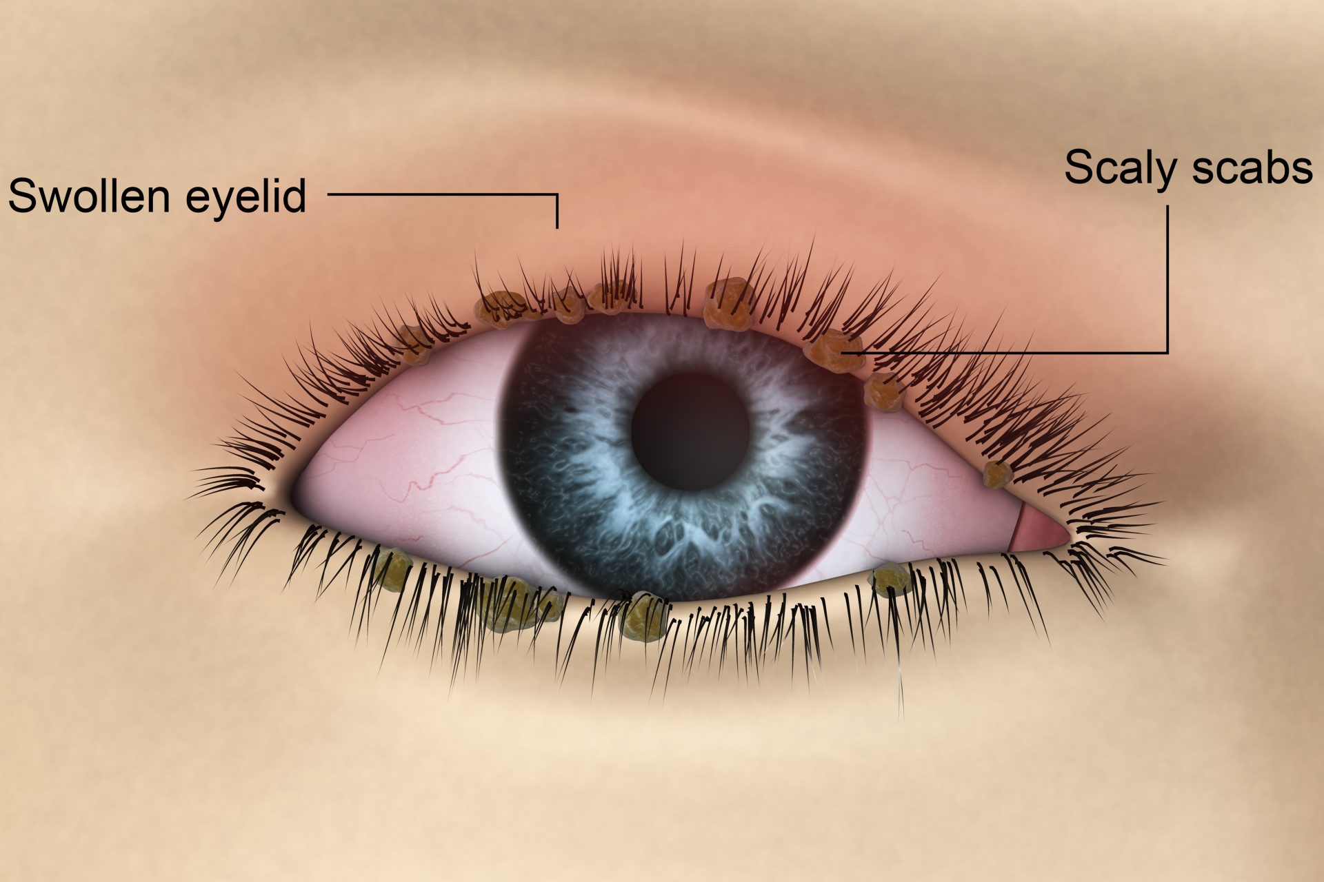 Rubbing your eyes: A common habit that has more dangers than you may think!
