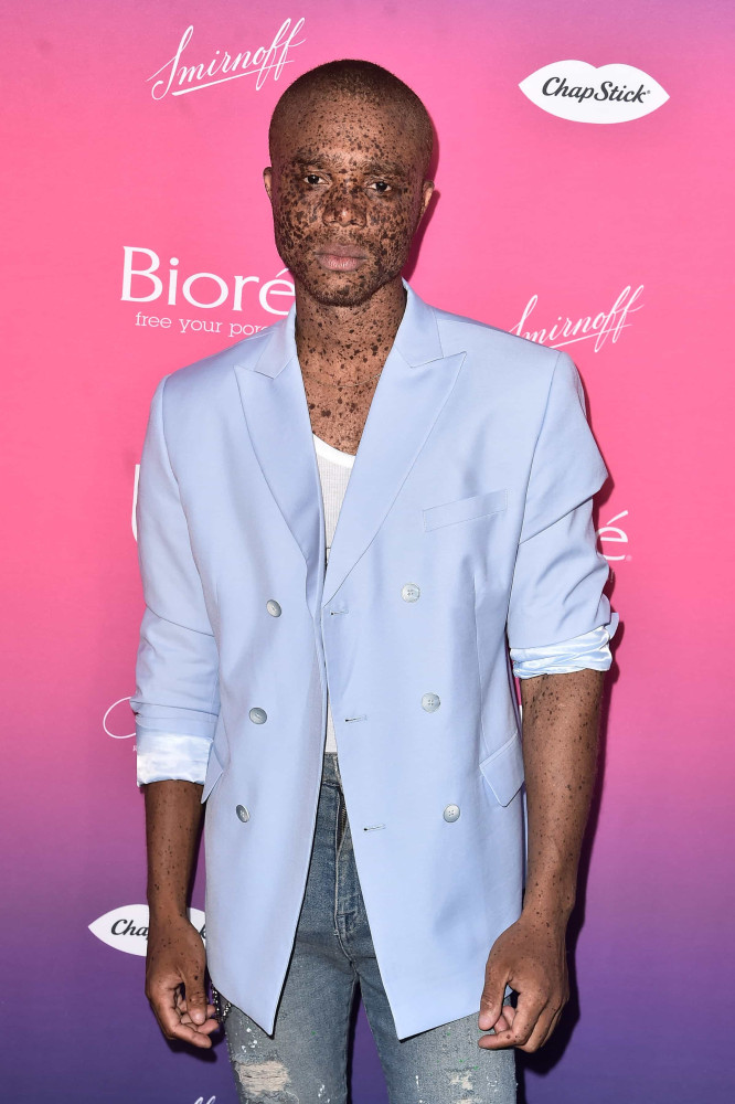 Models who defy traditional beauty standards