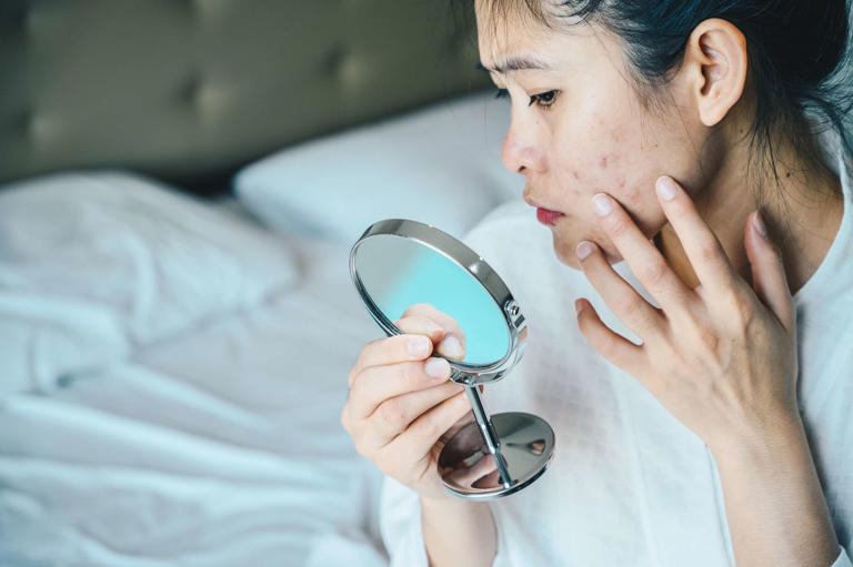 How to recognize and clear up fungal acne