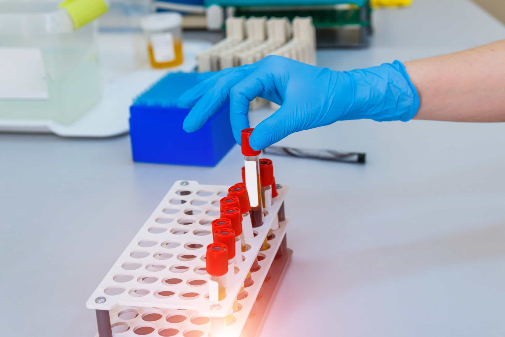 This is how your blood type can affect your health