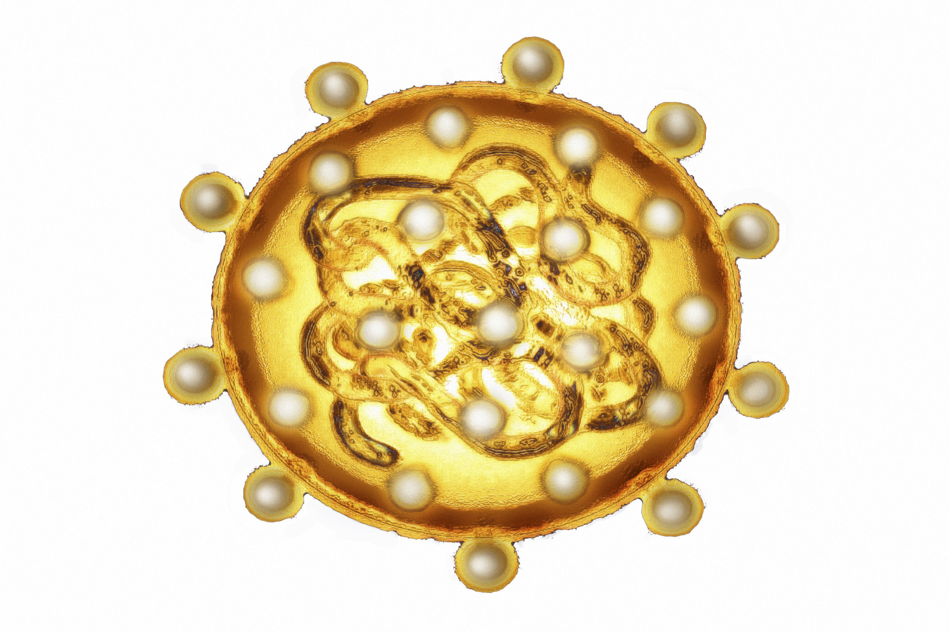 What happened to the girl who shocked the world in the 1970s?