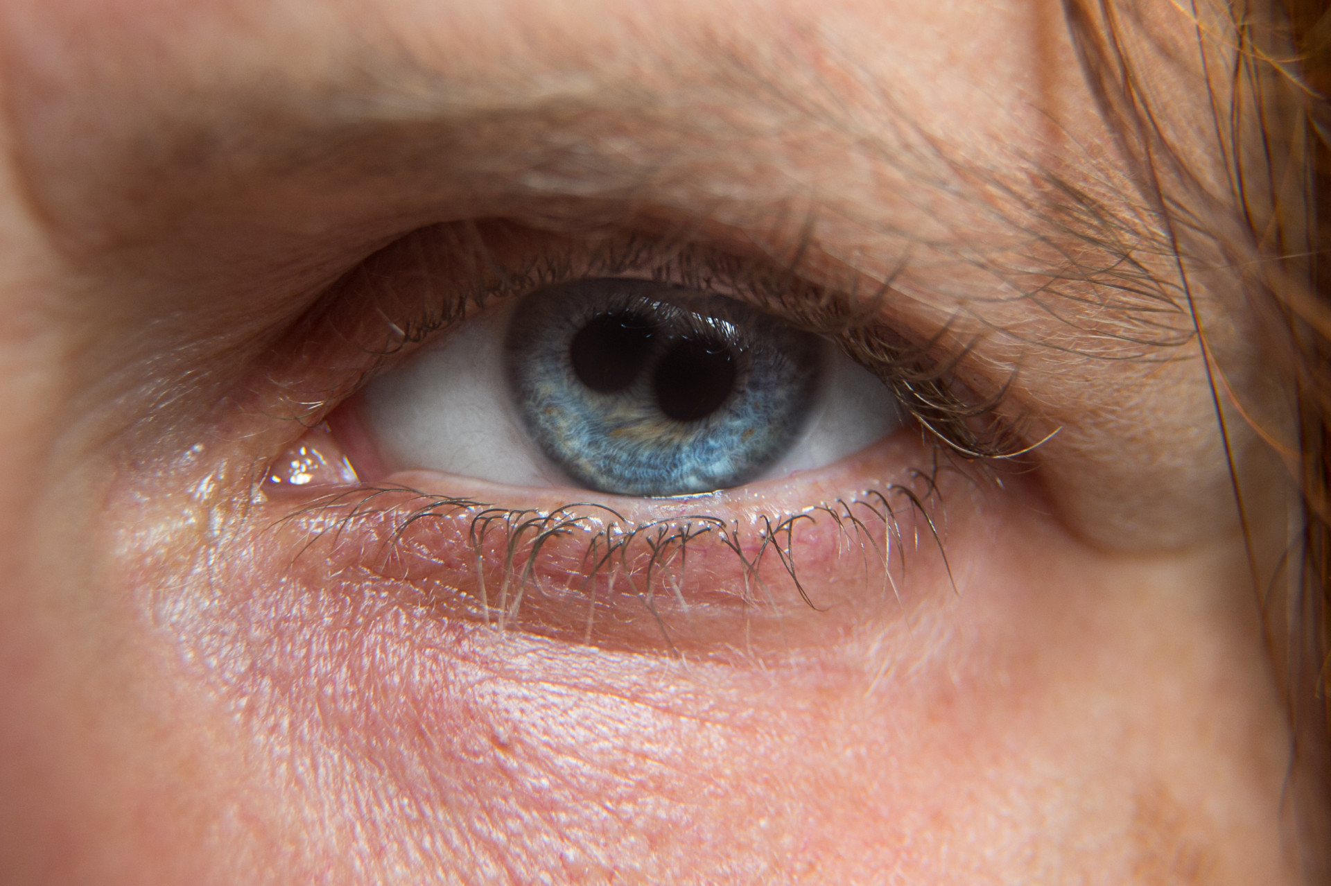 Rare human body features you didn’t know exist