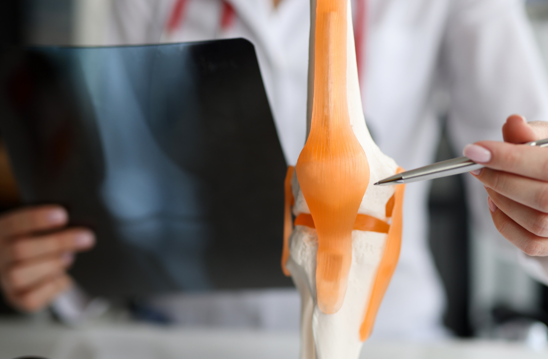 The painful and debilitating condition that is arthritis