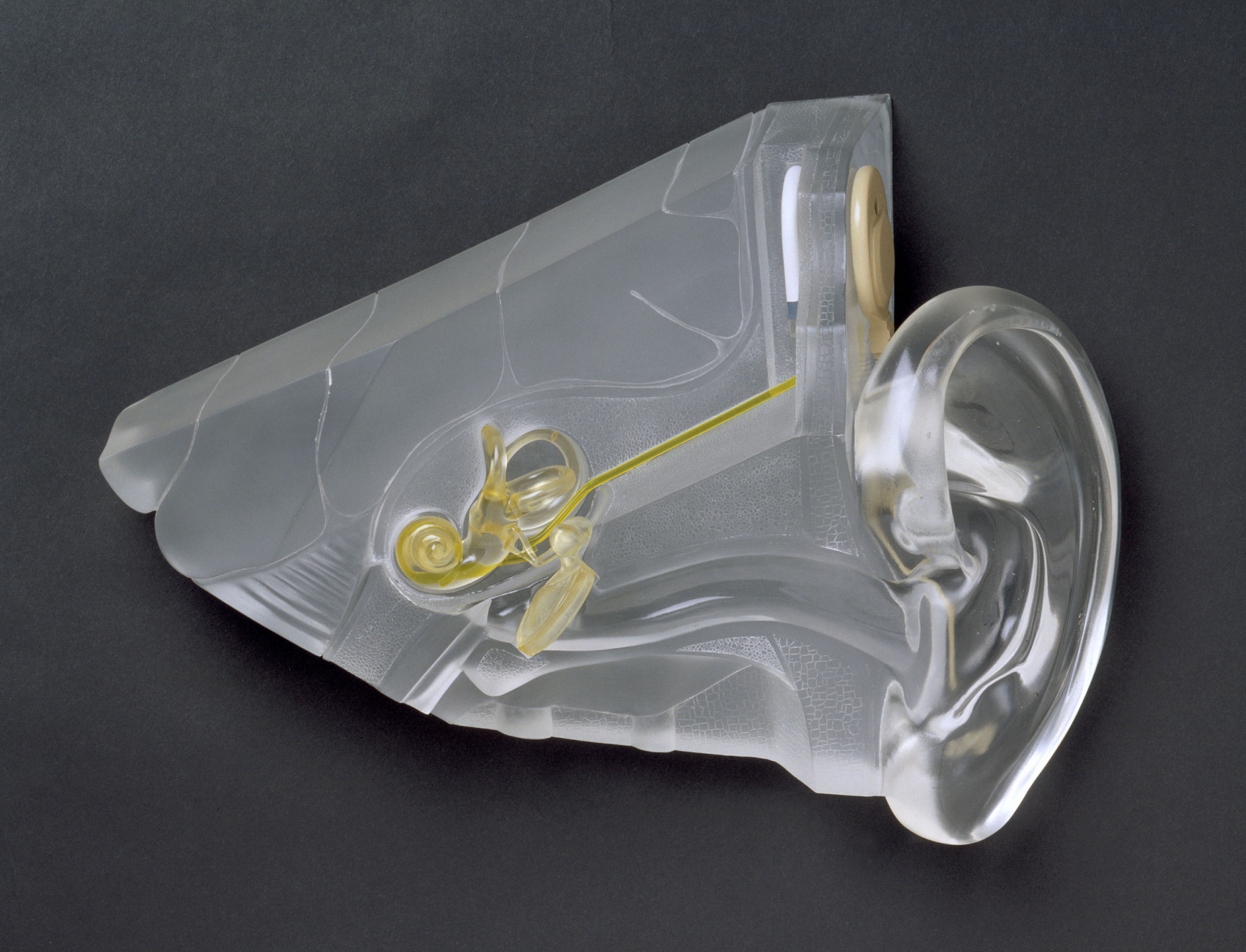 The invention story of the hearing aid