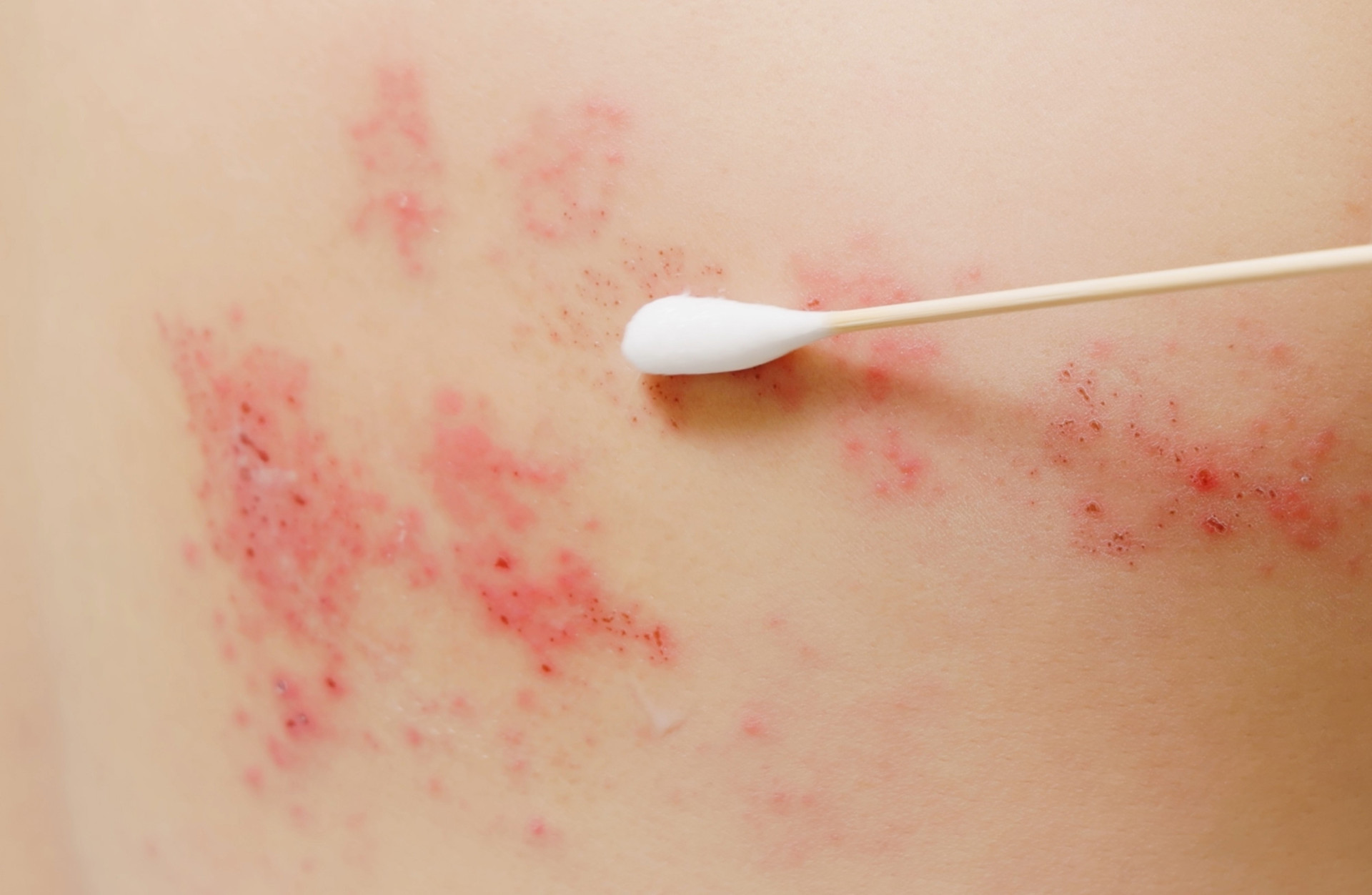 What are the worst medical pains that humans can suffer?