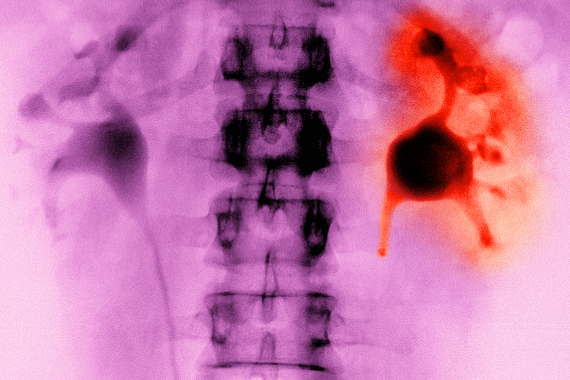 En översikt över svåra medicinska smärtor och deras orsaker