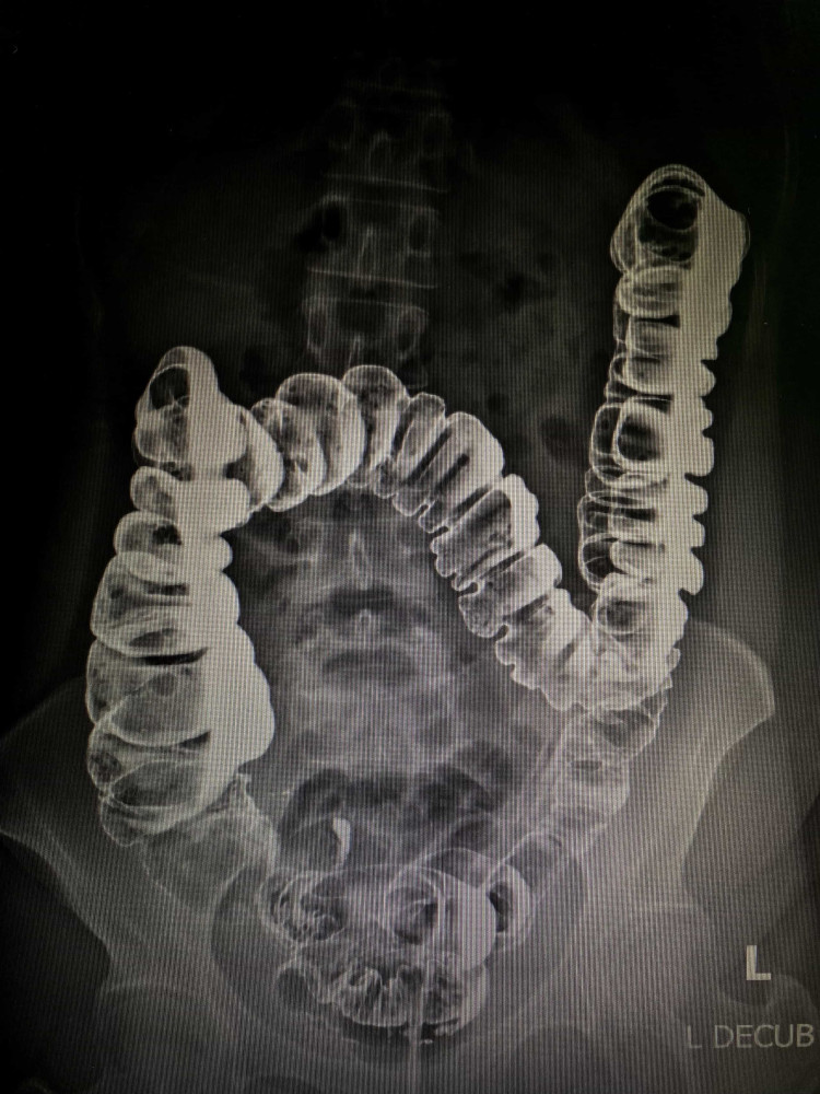 Cancer screening: what tests you should be doing and when
