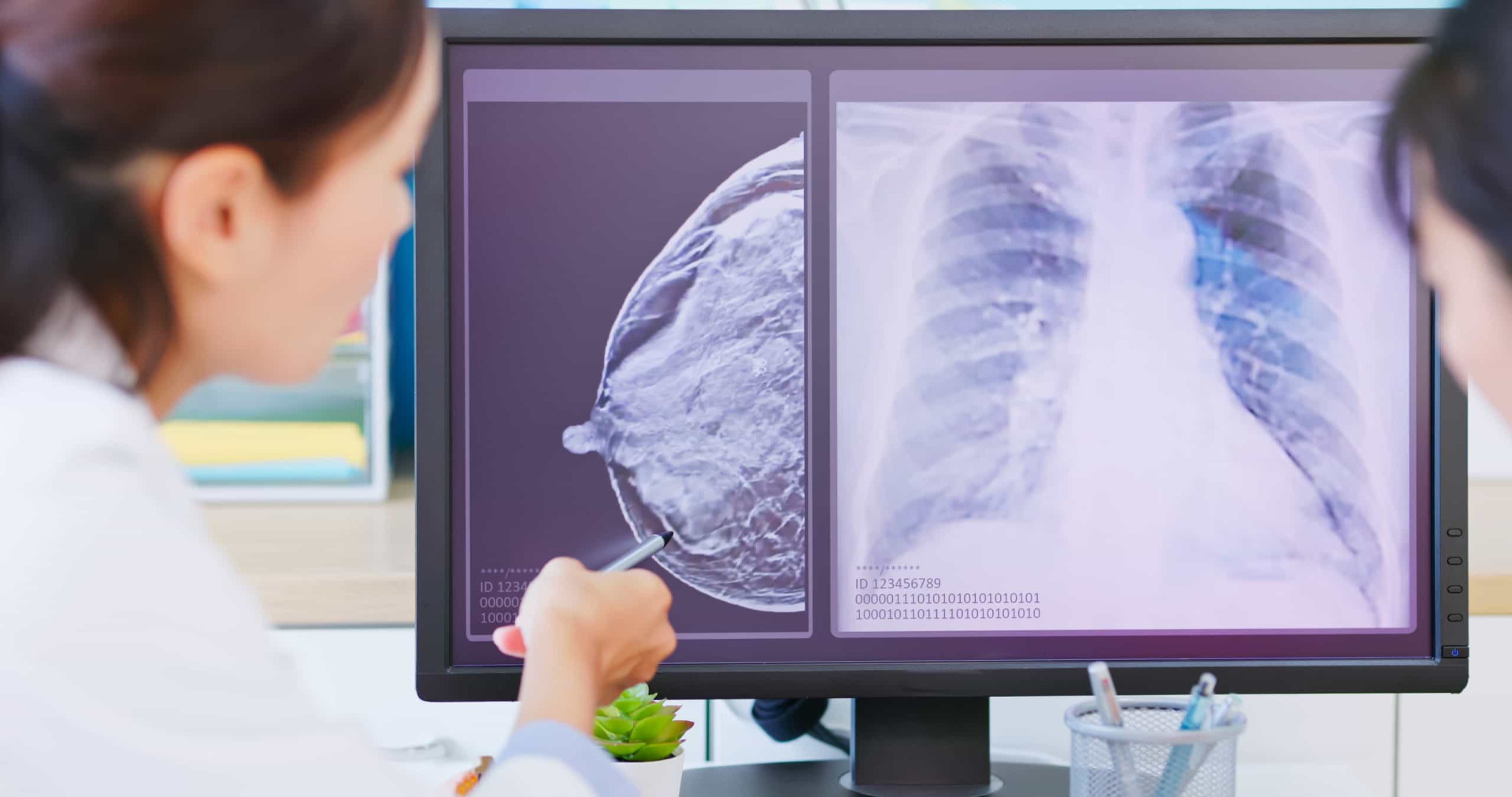 Cancer screening tests: When should you do them?
