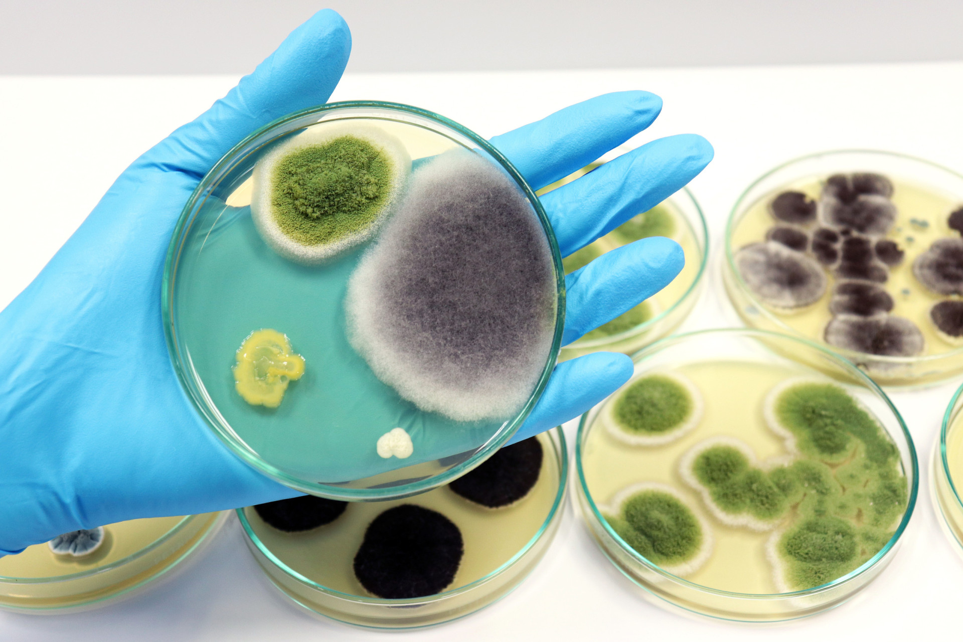 Infections fongiques : ce que vous ignorez sur les mycoses