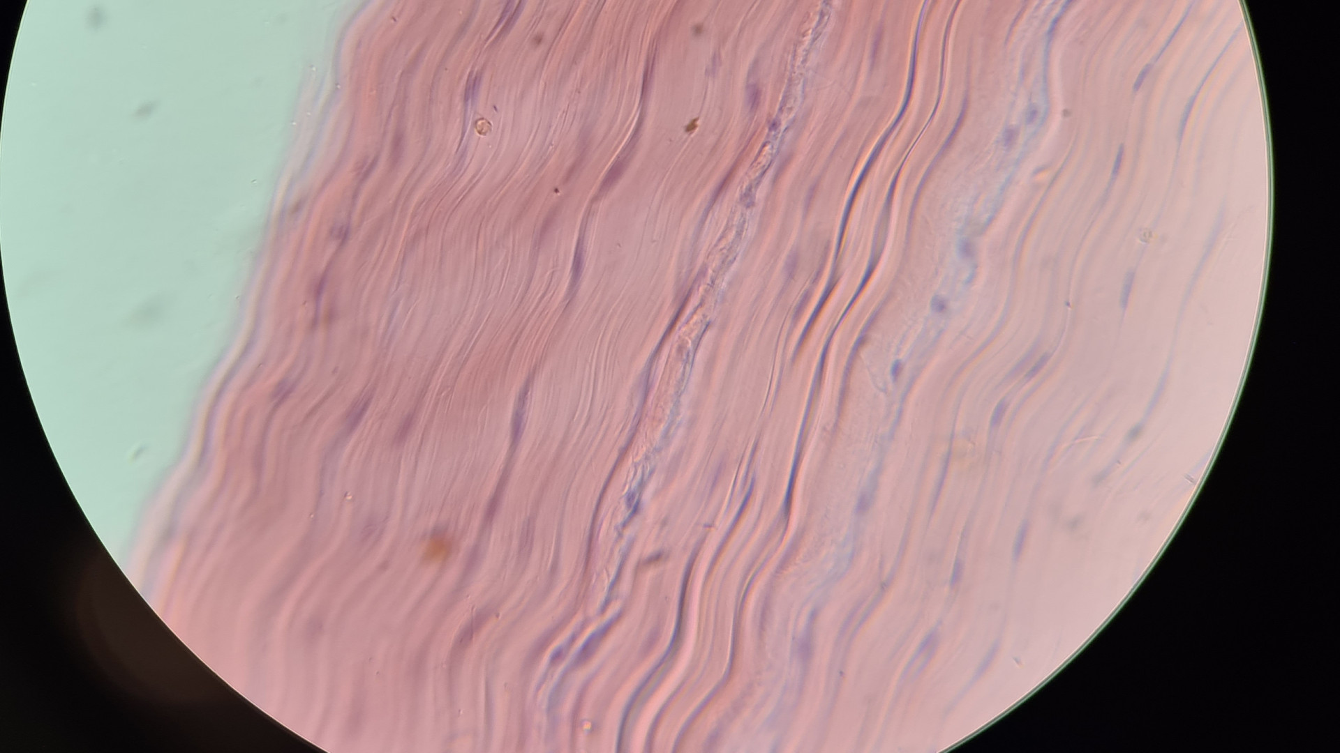 Is fascia the key to better health?