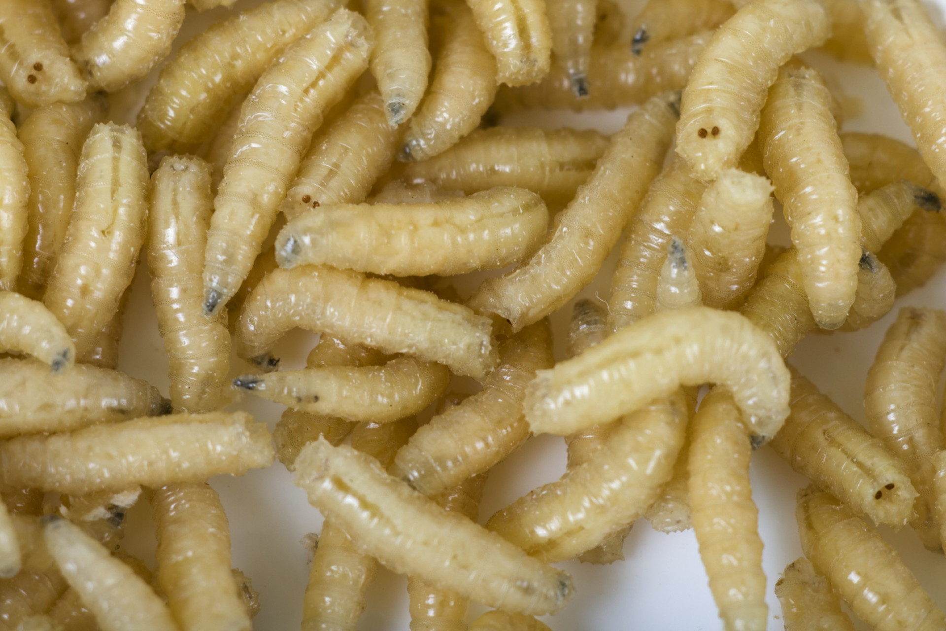 The weirdest things ever found inside the human body