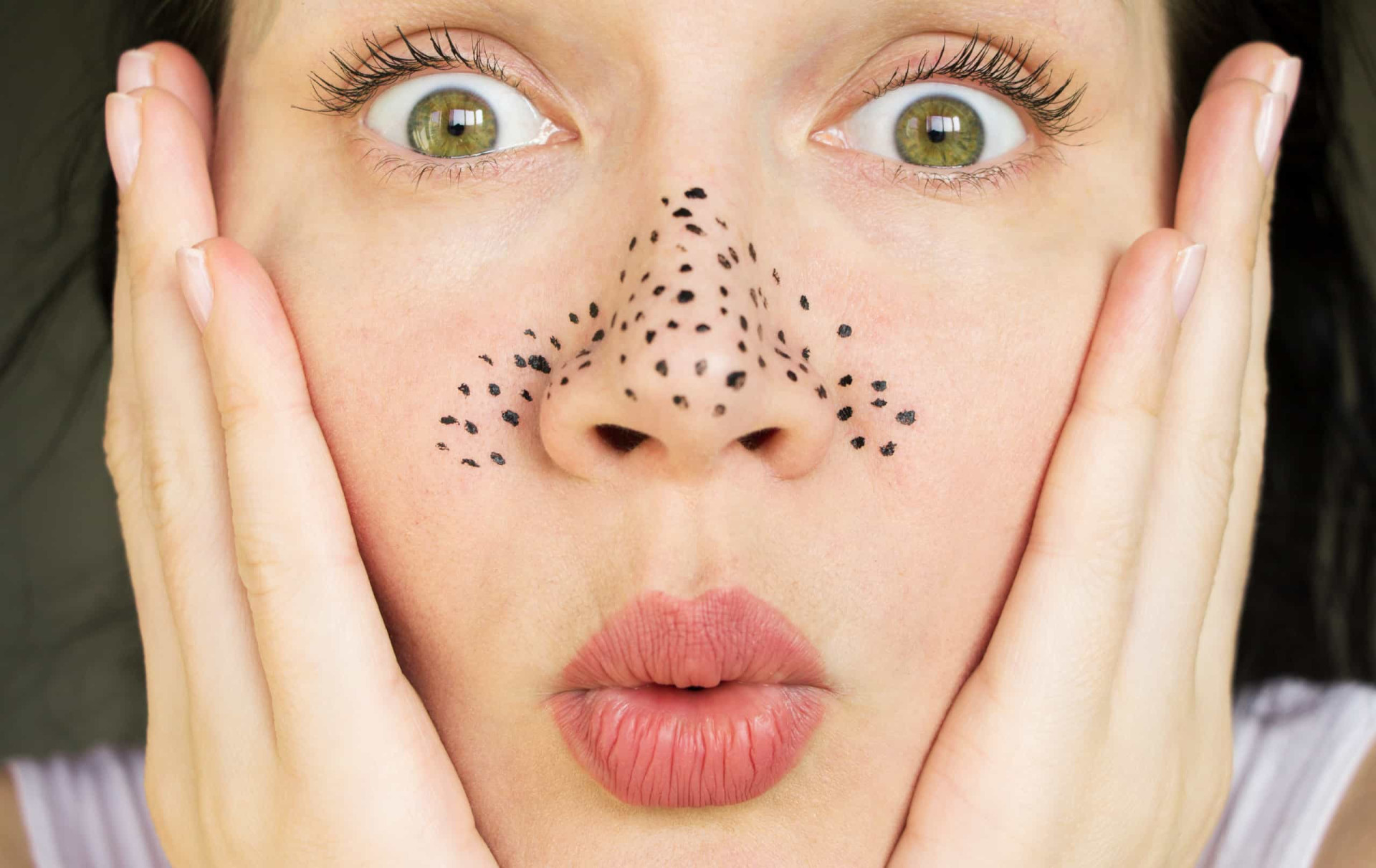 Blackheads: The best and worst ways to remove them