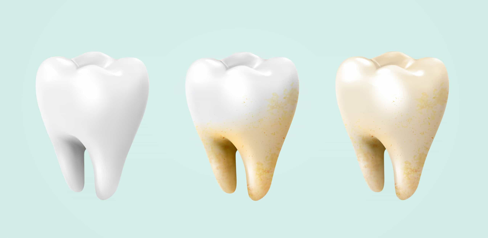 Qué Le Ocurre A Nuestro Cuerpo Cuando No Nos Lavamos Los Dientes