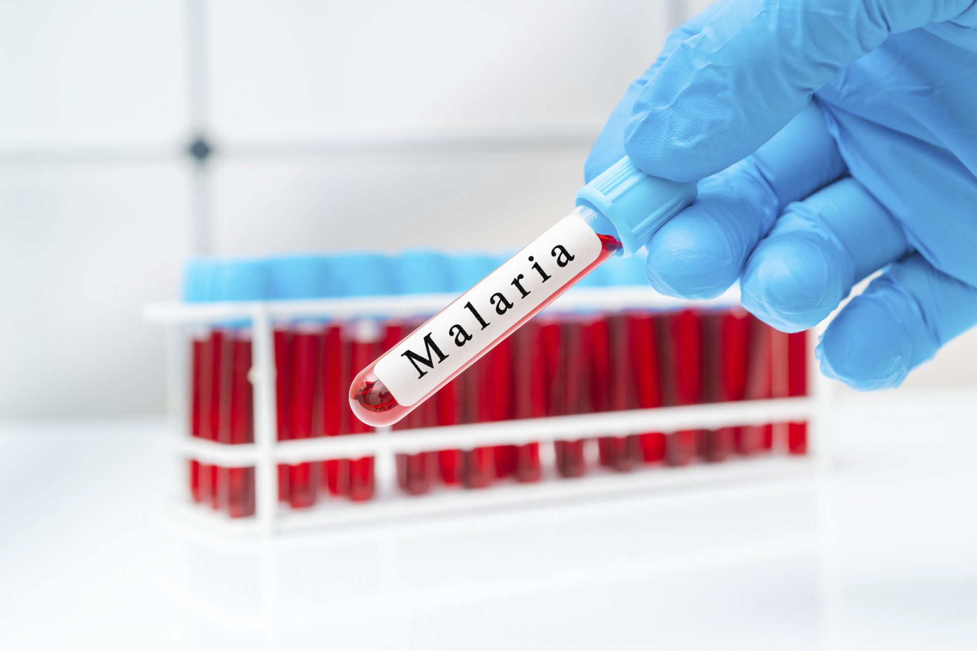 Harvard scientists develop a completely new approach to cure malaria