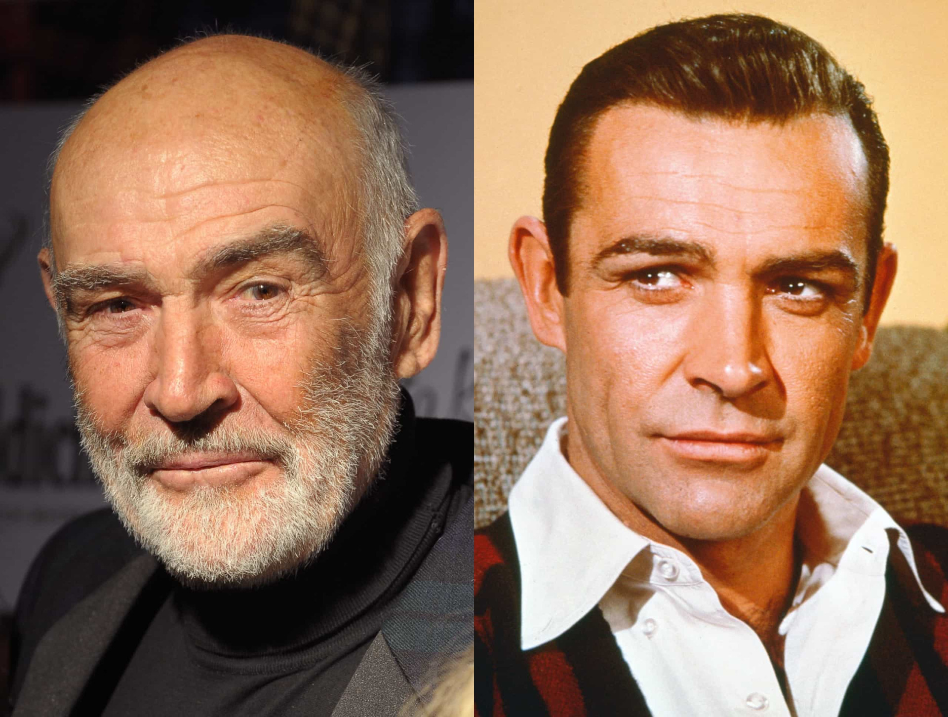 Do you remember when these bald stars still had hair?