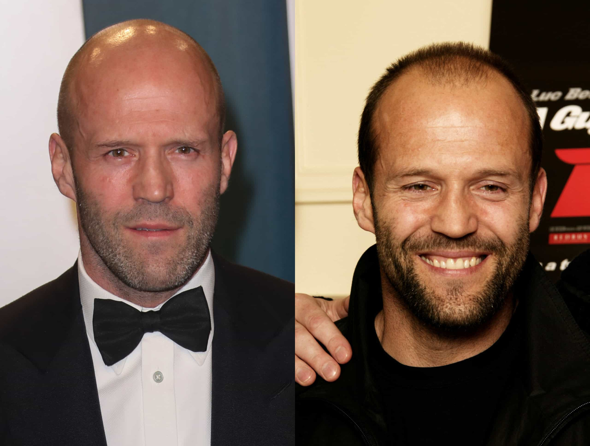 Do you remember when these bald stars still had hair?