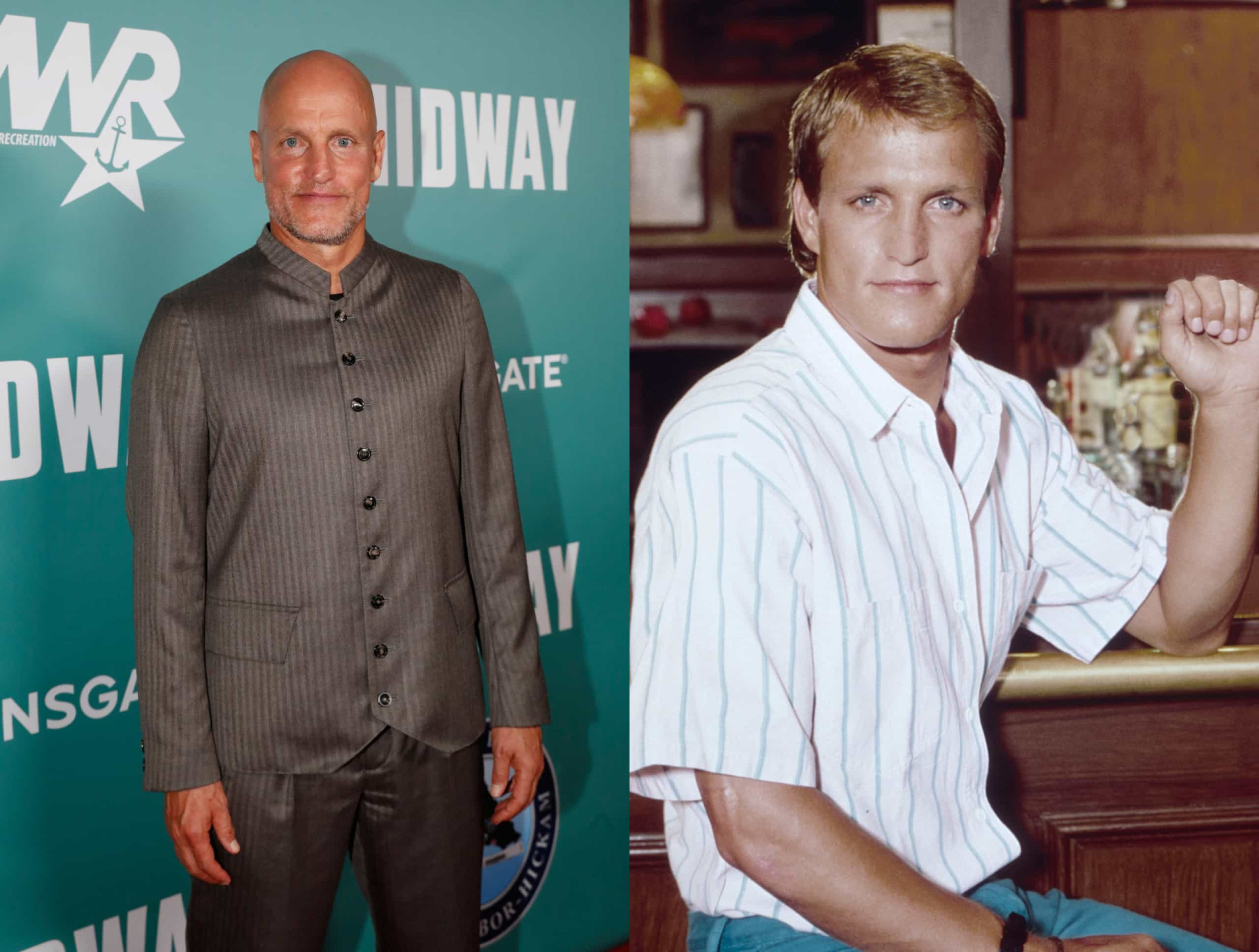 Do you remember when these bald stars still had hair?