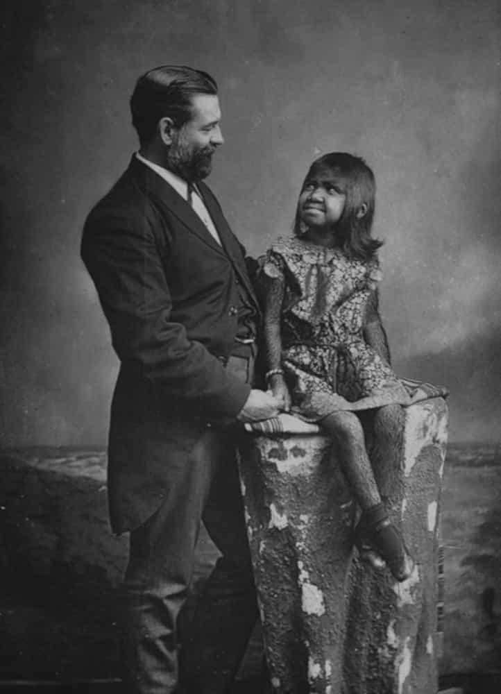 The dark history of bearded ladies