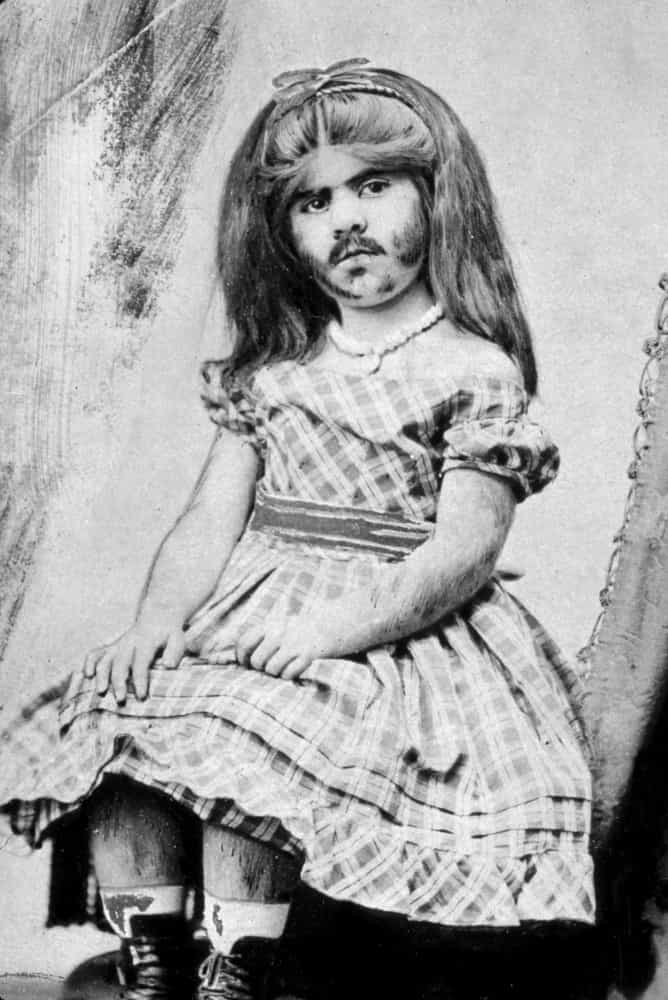 The dark history of bearded ladies