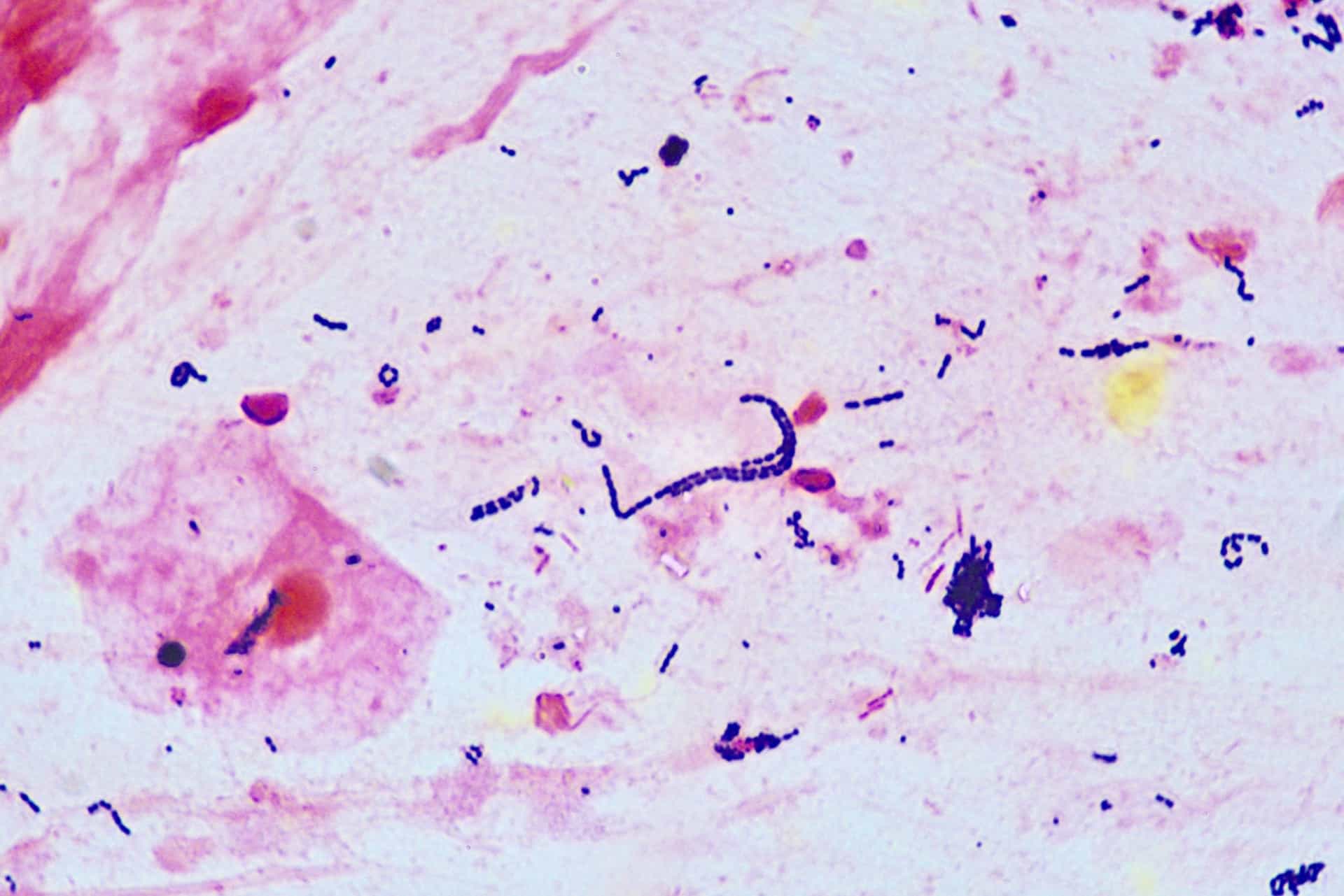 The harmful bacteria that can exist in the human body