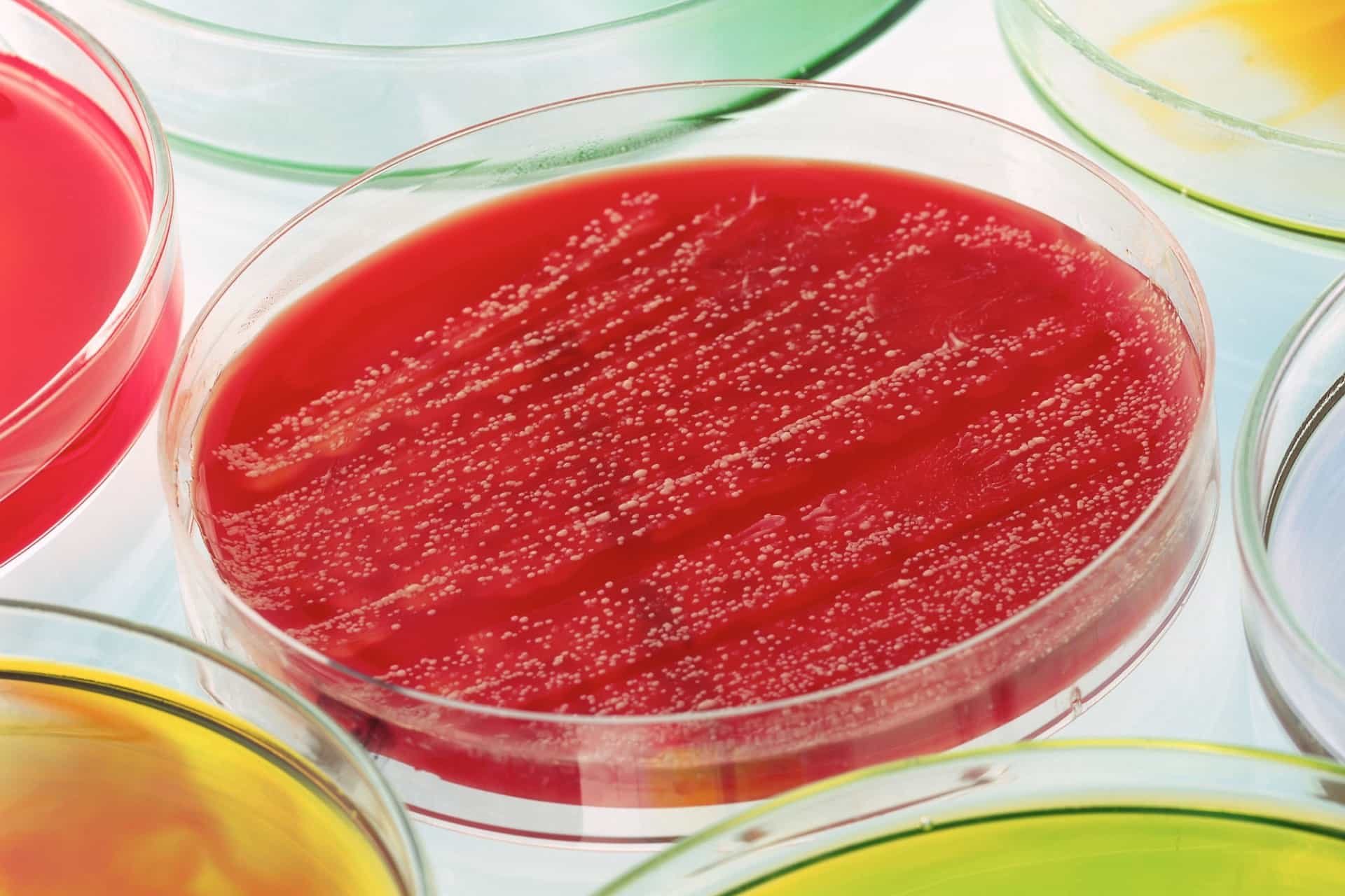 The harmful bacteria that can exist in the human body