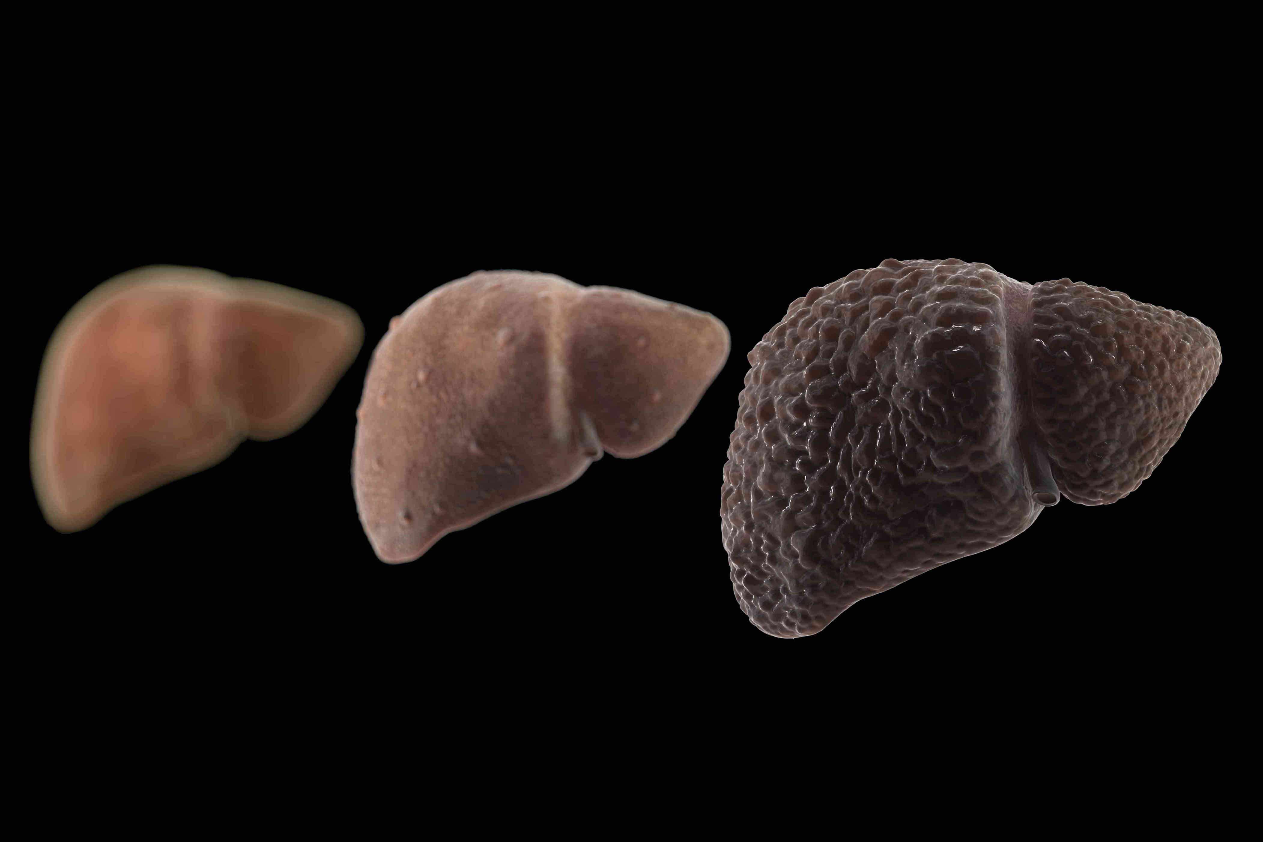 Understanding Liver Enzymes and Signs of Liver Dysfunction