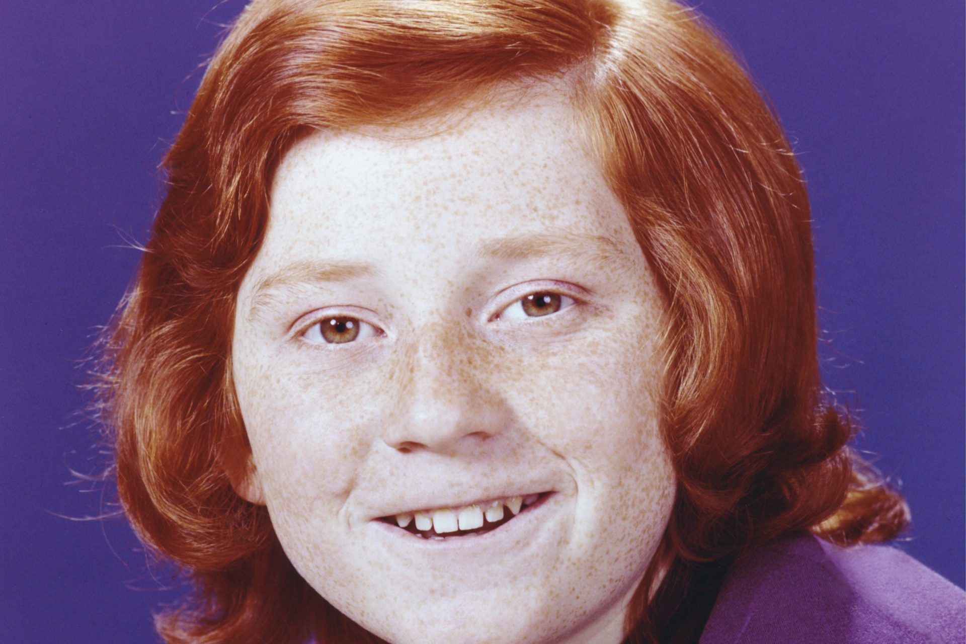 How is Danny Bonaduce doing since his brain surgery?