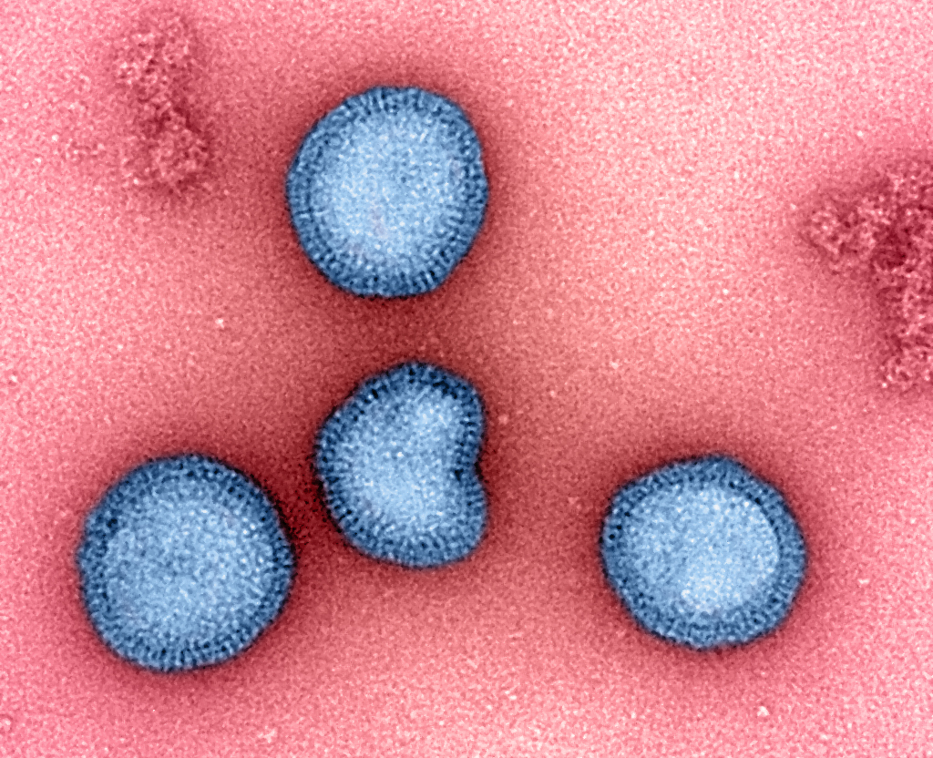 Covid killed off a dangerous flu lineage, sparking vaccine reformulation